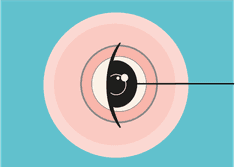 Award-winning Wirepas mesh technology – Discover how it works